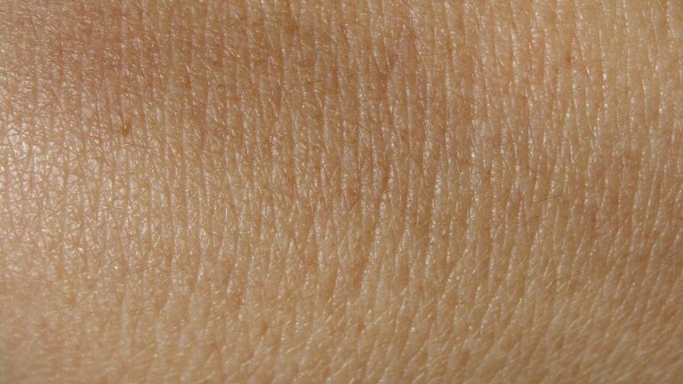 principales causas de la falta de pigmento en la piel - BIRISKA